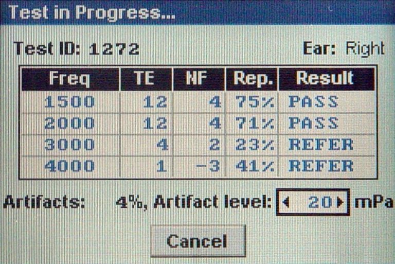 AuDXPro - OAE hearing screening - CodeConcept UK